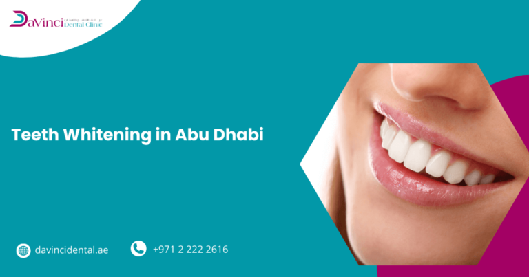 Best Teeth Whitening in Abu Dhabi - Davinci Clinic