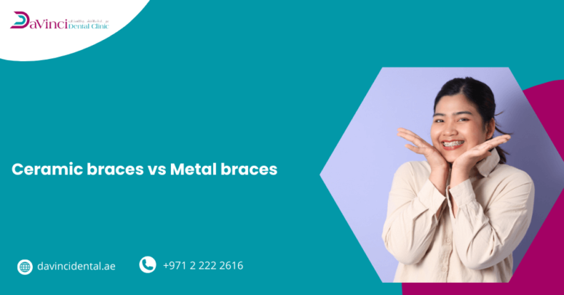 Ceramic Braces Vs. Metal Braces – Davinci Clinic