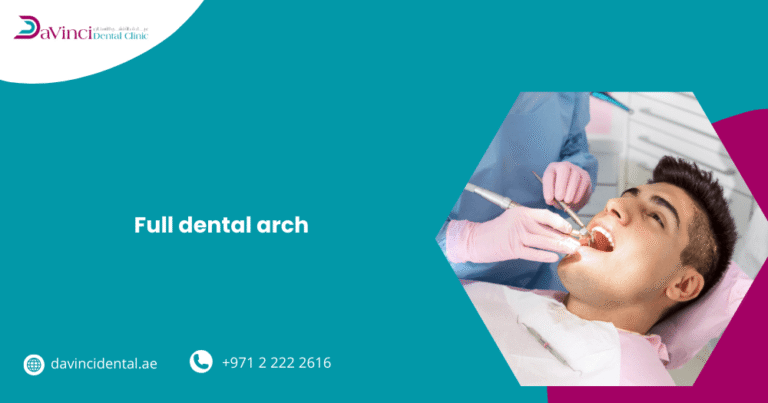 Full Arch Archives - Davinci Dental Clinic